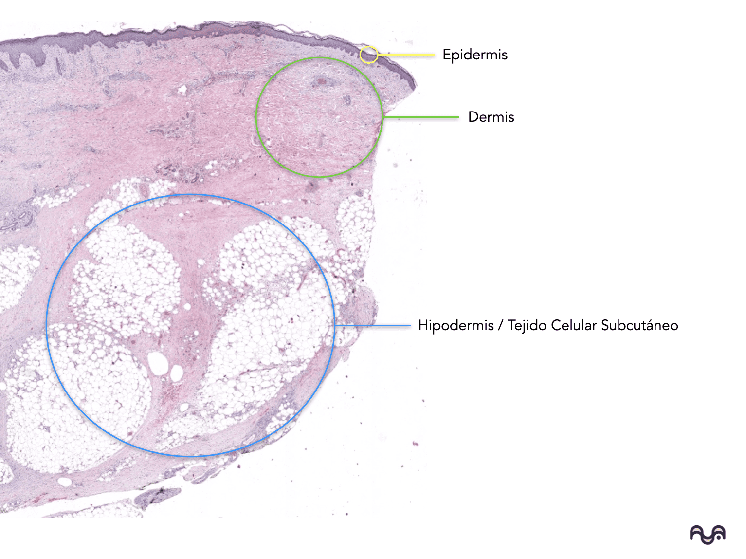 Histología de piel normal (módulo 4): La hipodermis: estructura ...