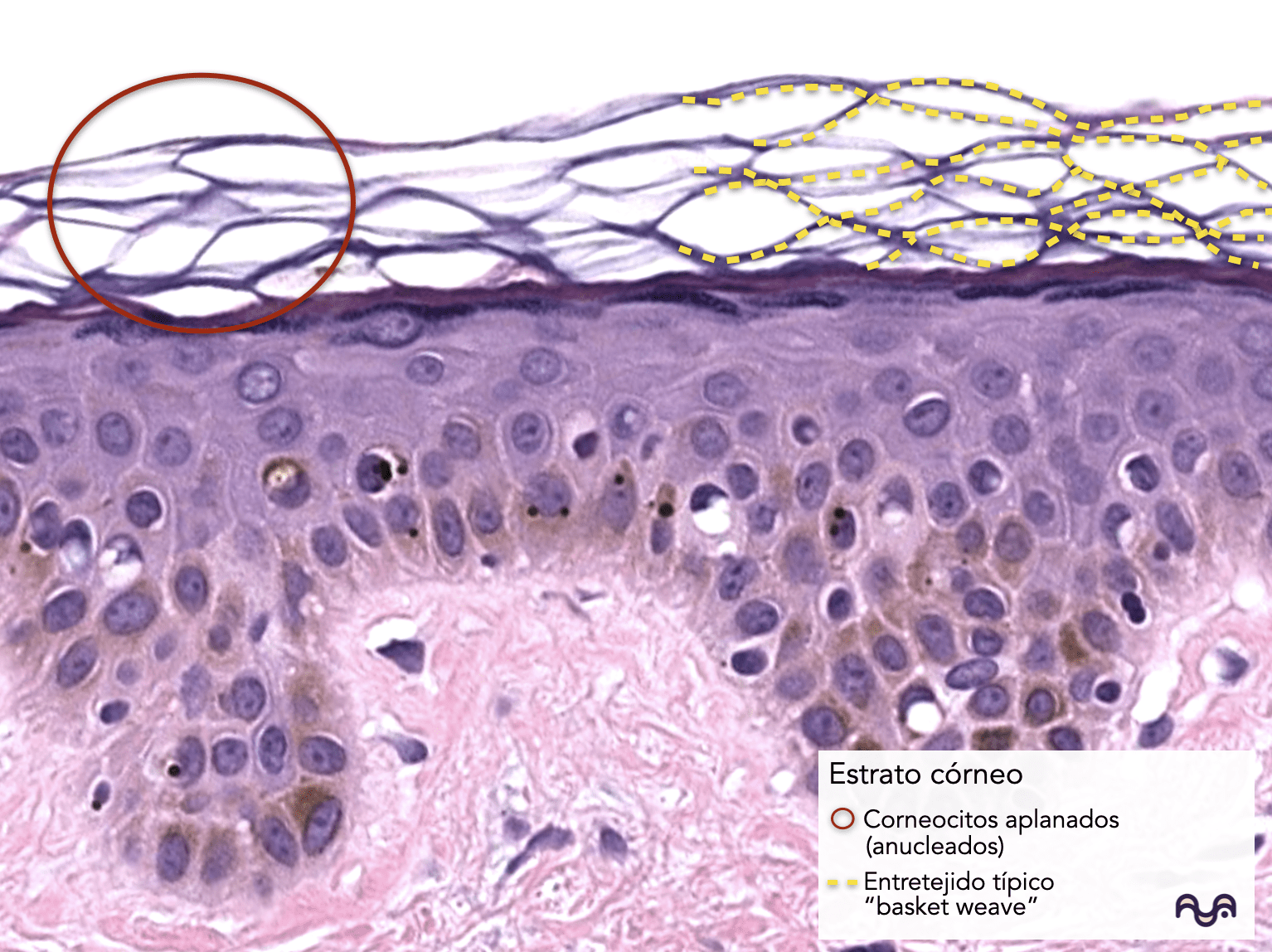 Histología de piel normal (módulo 2): La epidermis: estratos, células ...