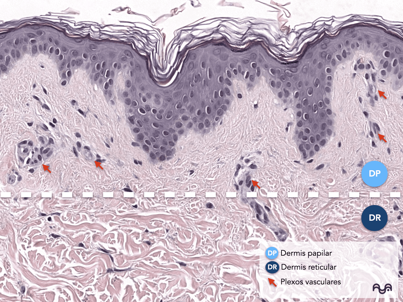 Histología de piel normal (módulo 3): La dermis: arquitectura, células ...