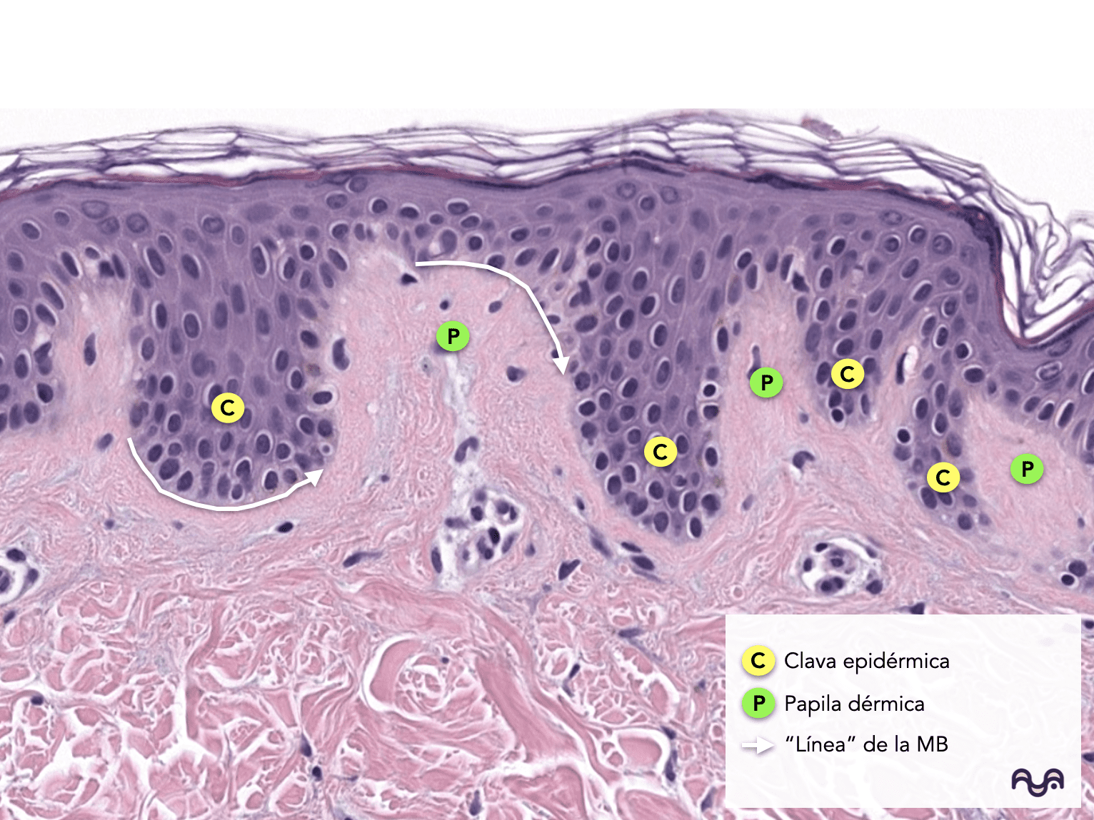 Histology of normal skin (module 5): The dermoepidermal junction